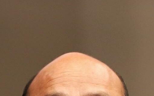 禿頭救星？台大團隊研發「20天生髮精華」登國際 1800萬外國網友關注：保護台灣 | 國際 | Newtalk新聞