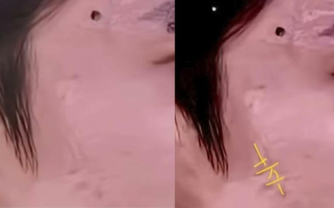 臉頰驚見「倒辛字」！李沐陽曝于朦朧疑遭惡意烙印：讓人心情煎熬 | 生活 | Newtalk新聞