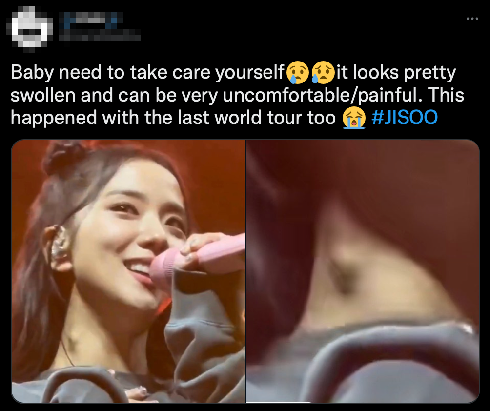 「世界最美」Jisoo「腫塊」照網瘋傳！最新「腫塊消失」畫面曝光 | 娛樂 | Newtalk新聞