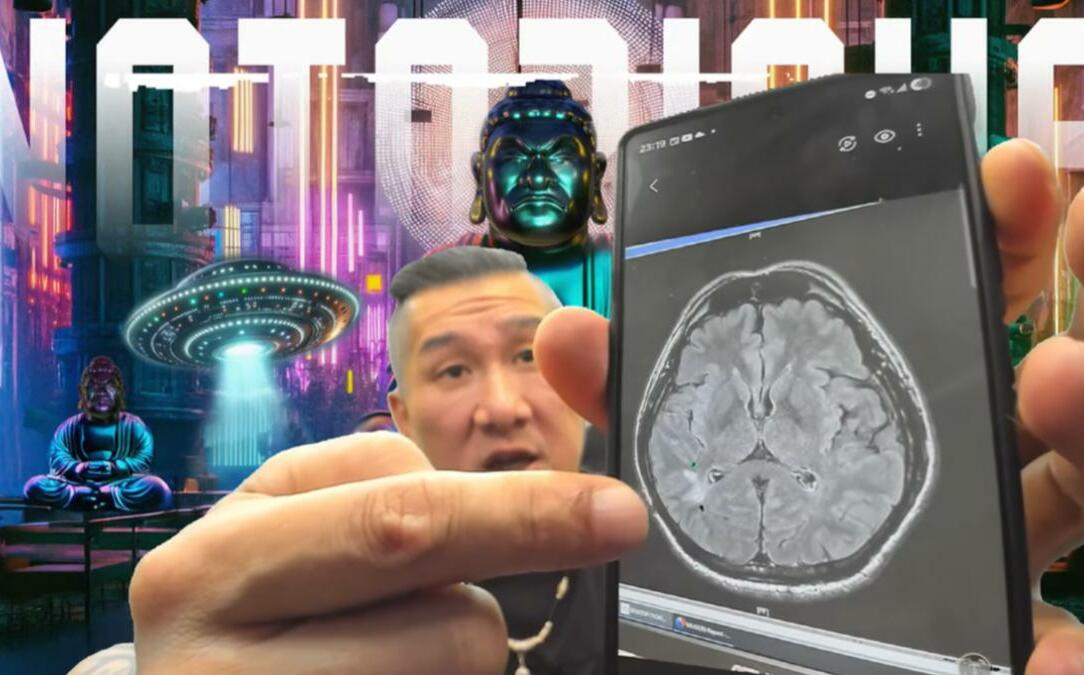 館長自曝「腦血管萎縮」! 健檢驚見X光片現白色陰影 將做MRI檢查 | 政治 | Newtalk新聞